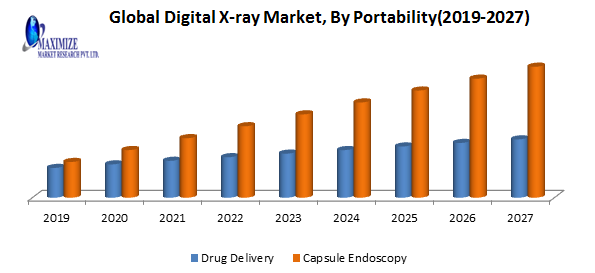 Global Digital X-ray Market-Industry Analysis and Forecast (2019-2027 ...